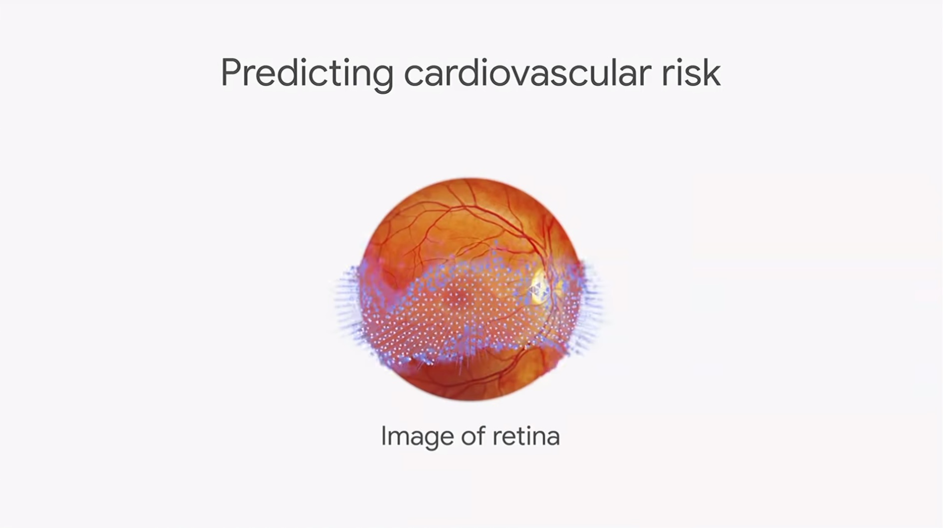 Google AI Levels Up Retinal Scans - ALEX SHOOLMAN