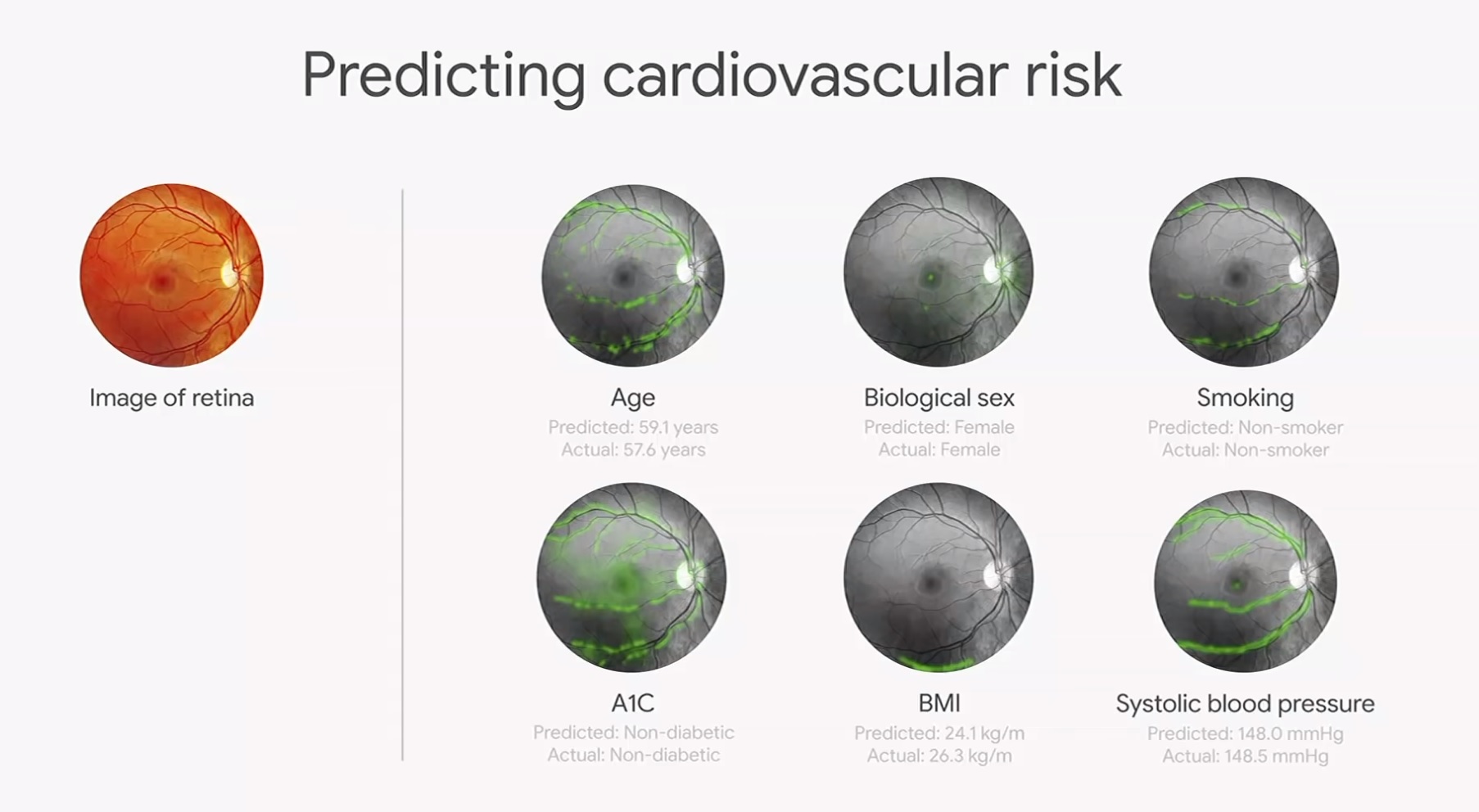Google AI Levels Up Retinal Scans - ALEX SHOOLMAN